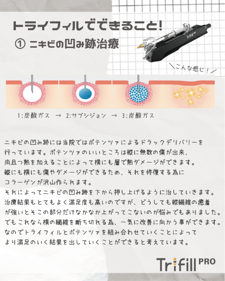 トライフィルプロ ‣ 飯田橋ともじり皮ふ科